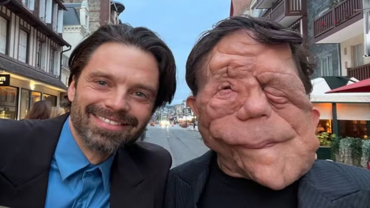 Adam Pearson: doença que afeta rosto do ator, neurofibromatose, tem ...